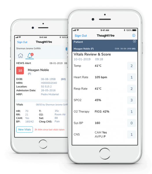 Code Blues can be Predicted and Preempted before they happen